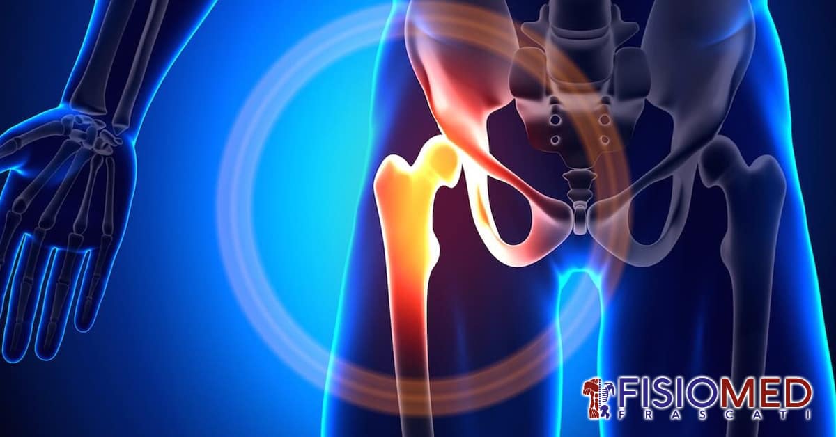 La pubalgia: di cosa si tratta? • Fisiomed Frascati